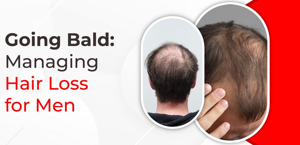 Going Bald Managing Hair Loss for Men
